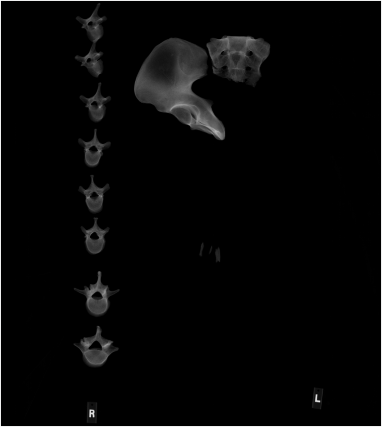 Advancing Forensic Anthropology: Imaging Innovations - Linev Innovations