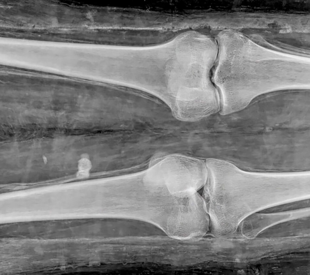 X-ray Insights: What Lies Beneath Mummy Wrappings? - Linev Innovations